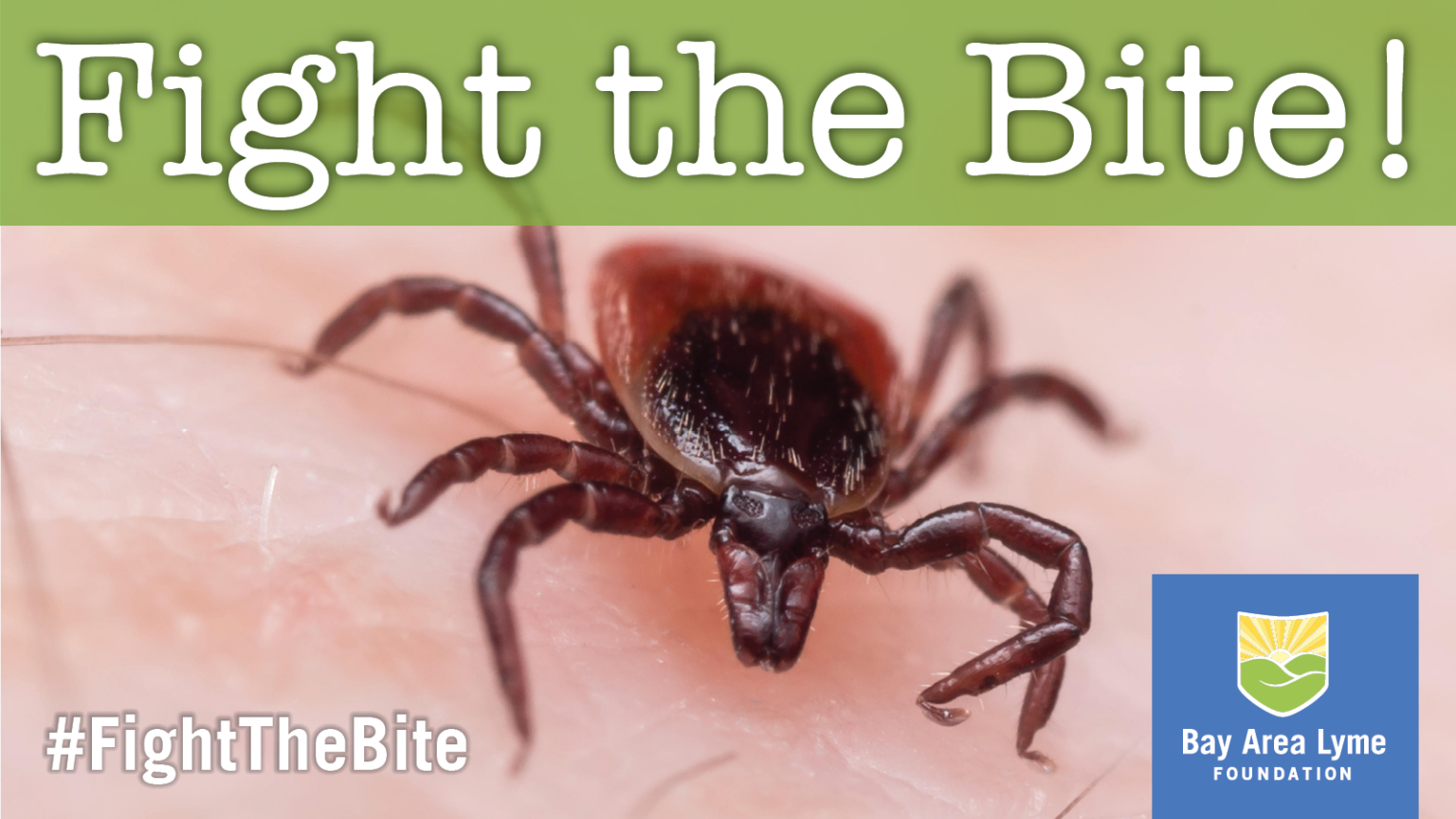 Lyme Disease Awareness Month Social Media Toolkit - Bay Area Lyme ...